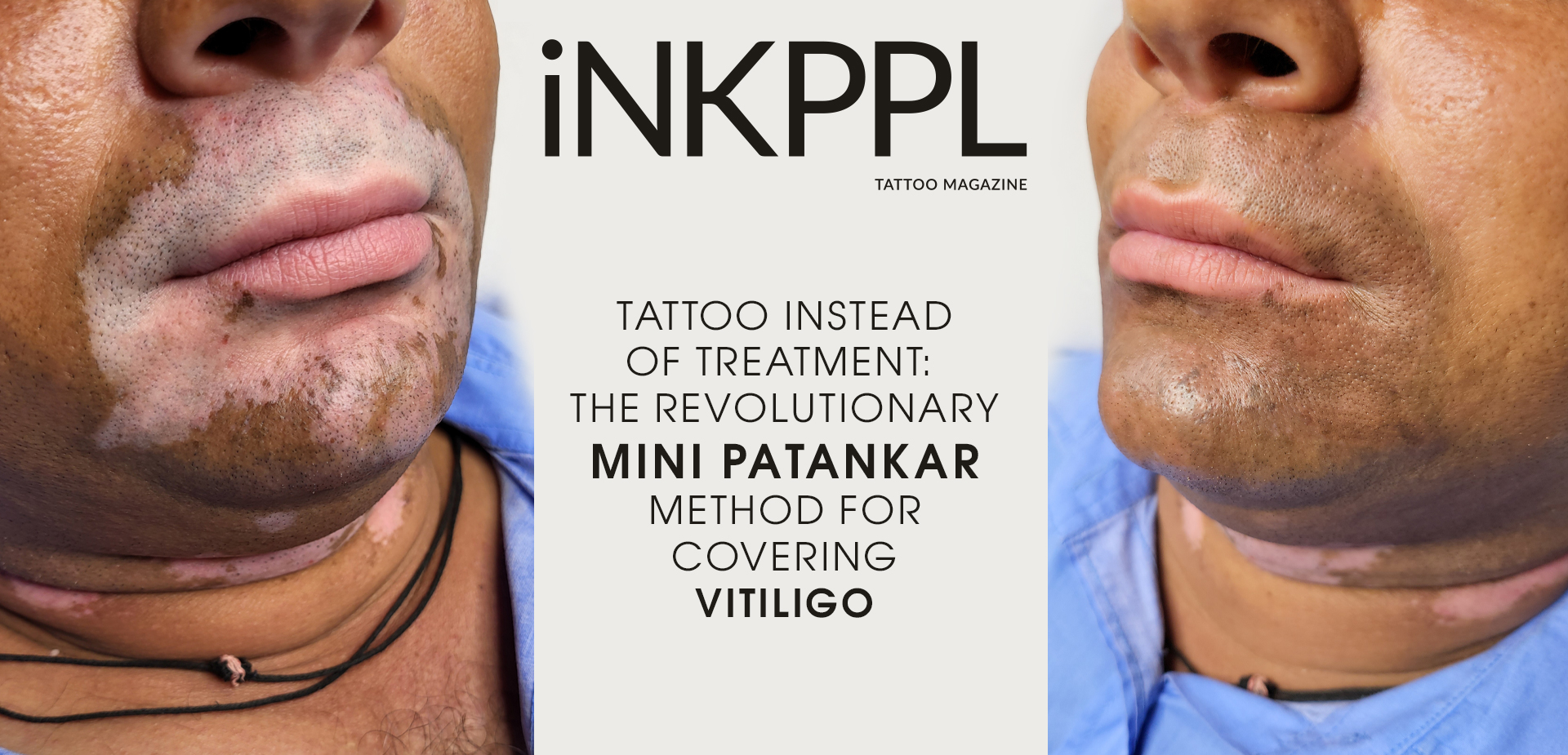 Vitiligo tattoo ideas | Orangetattooshop.com